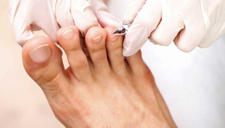 Take Proper Care Of Your Toenails • Kelsey McIntyre